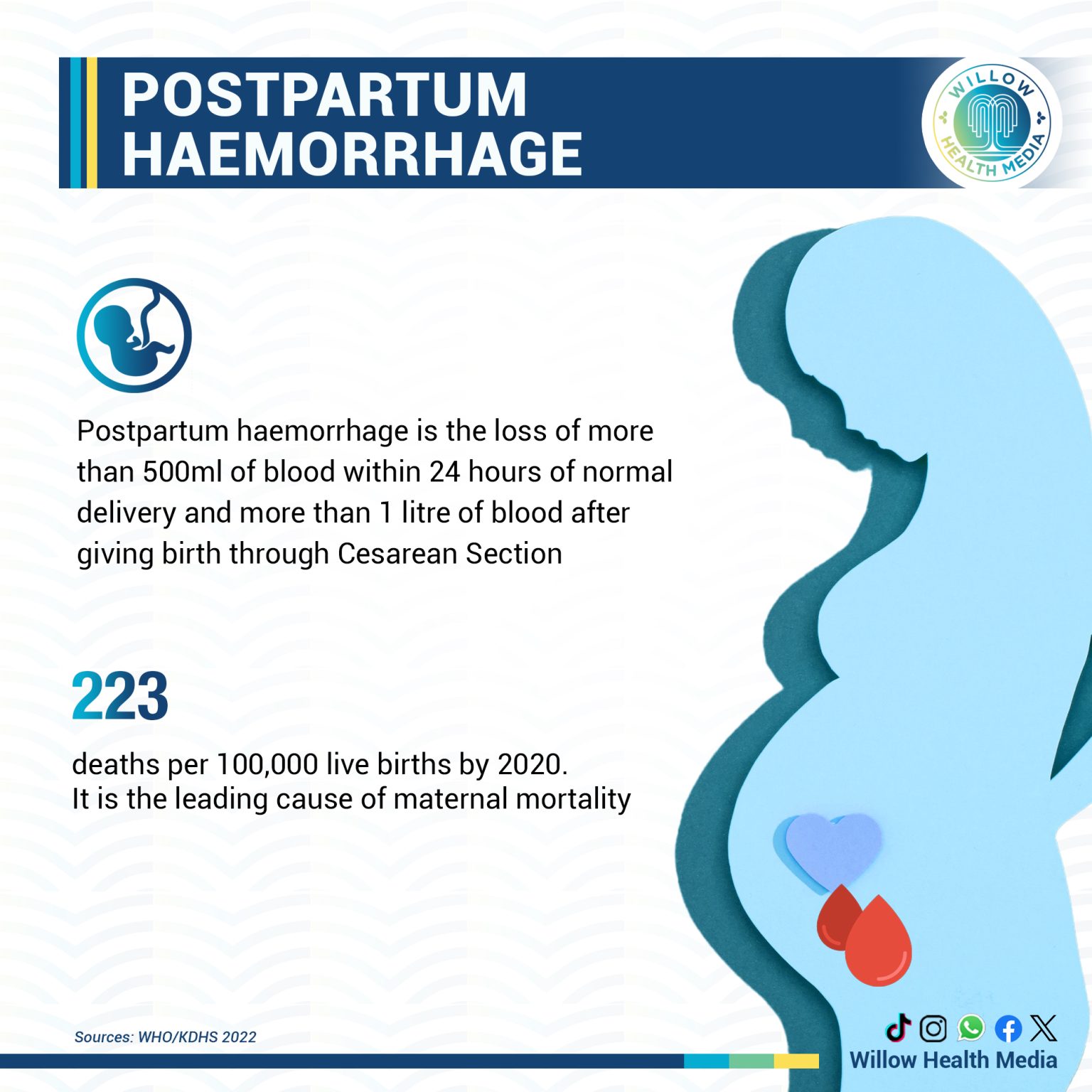 Postpartum haemorrhage: Key facts, risks and lifesaving measures ...